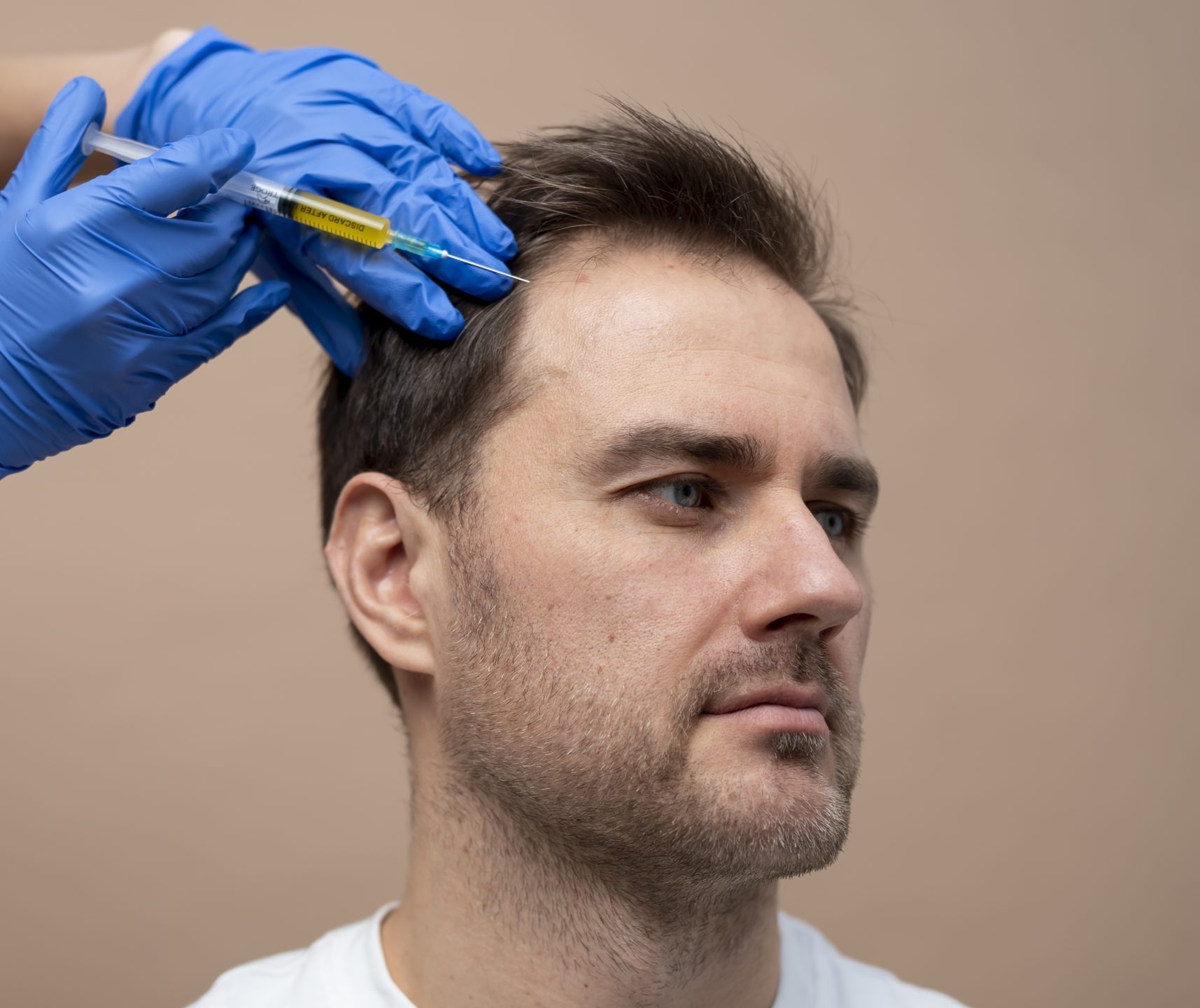 man-getting-prp-injection-alopecia - Lumiere Clinic